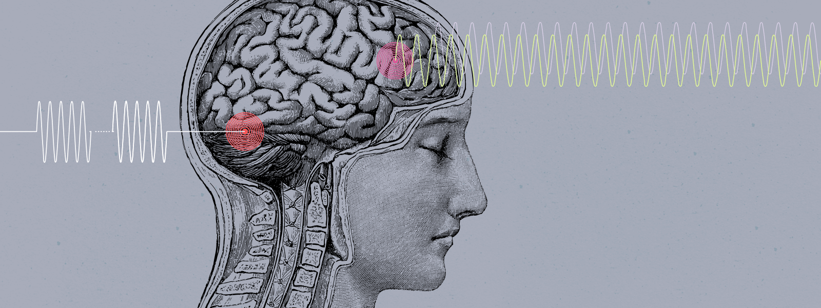 Sounding out the brain | Knowable Magazine