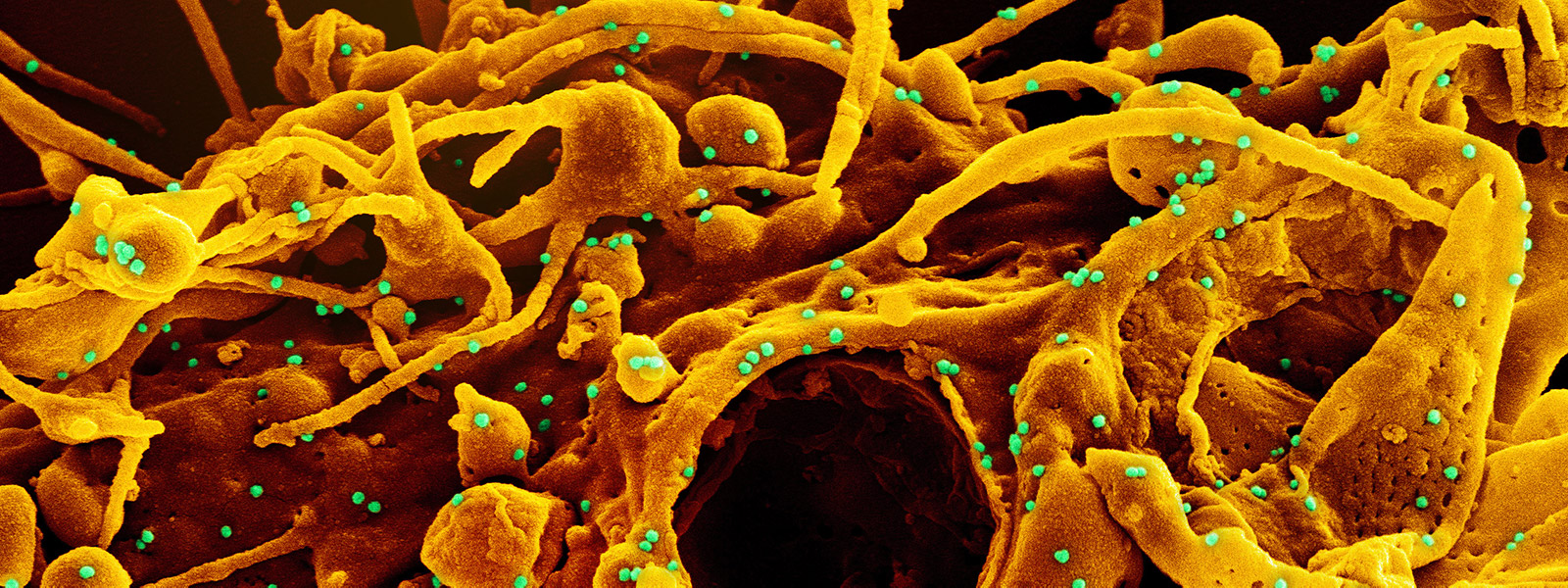 SARS-CoV-2: Evolution of a virus | Knowable Magazine