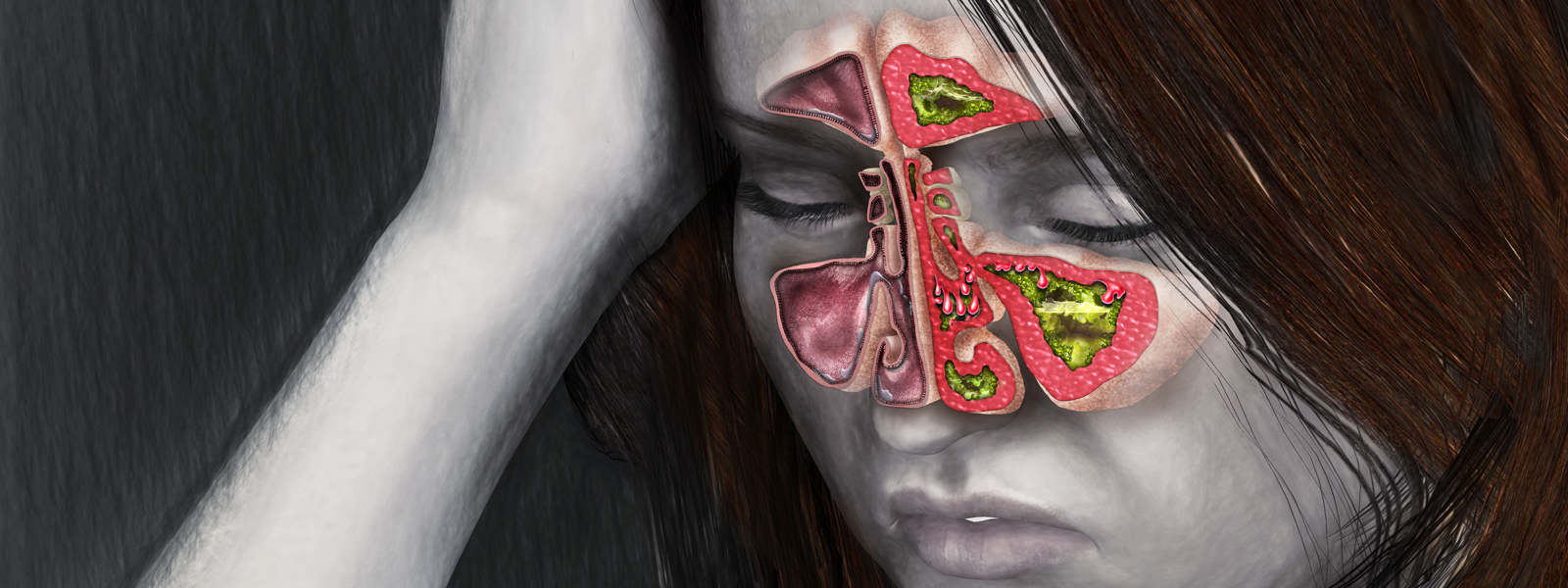 Snot what you think: The unknown toll of chronic sinus problems ...