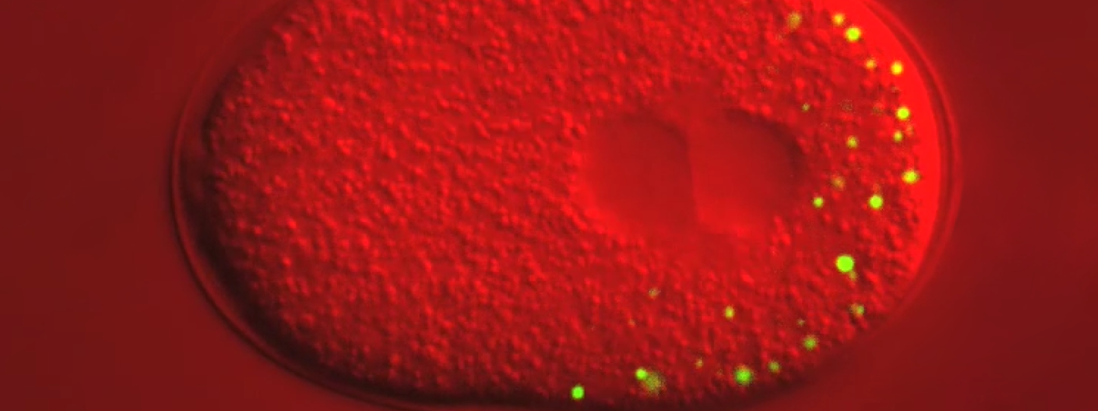 Tiny liquid droplets are driving a cell biology rethink | Knowable Magazine